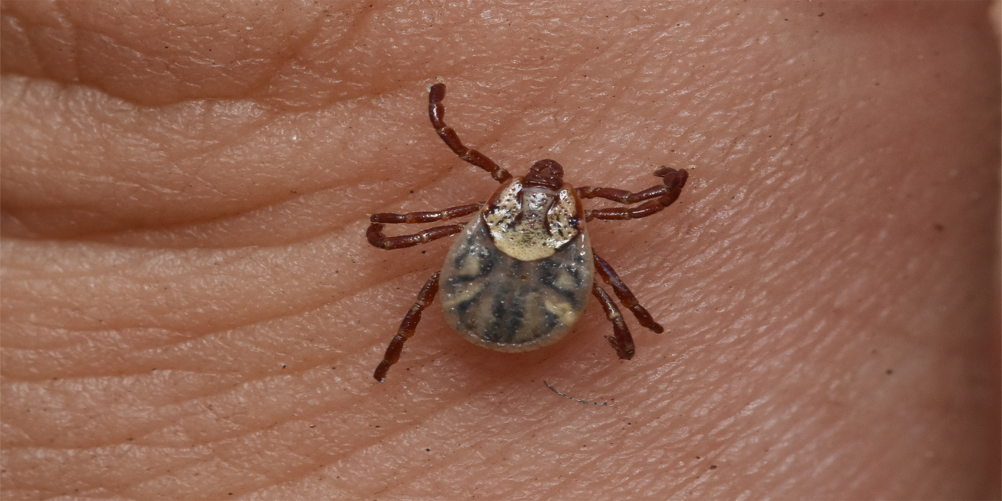 Tick guide: How to identify, remove ticks | Golden Gate National Parks ...